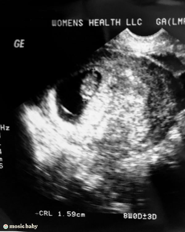 Mastering Ovulation, Understanding Cervix Was Key for New Mamas - Mosie ...